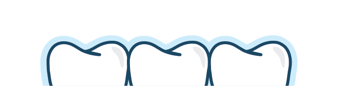 Sensitive Teeth Guide Top 7 Causes And Remedies Smile Brilliant