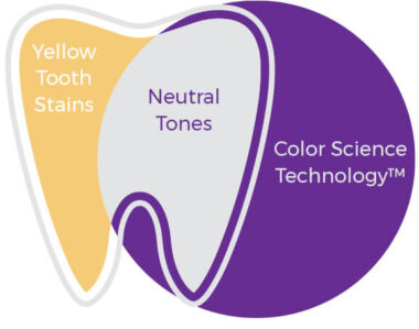 Night Out! Purple Toothpaste Stain Concealer | Smile Brilliant®